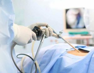 Gall Bladder Stone Surgery | Laparoscopy Surgery in Bannerghatta